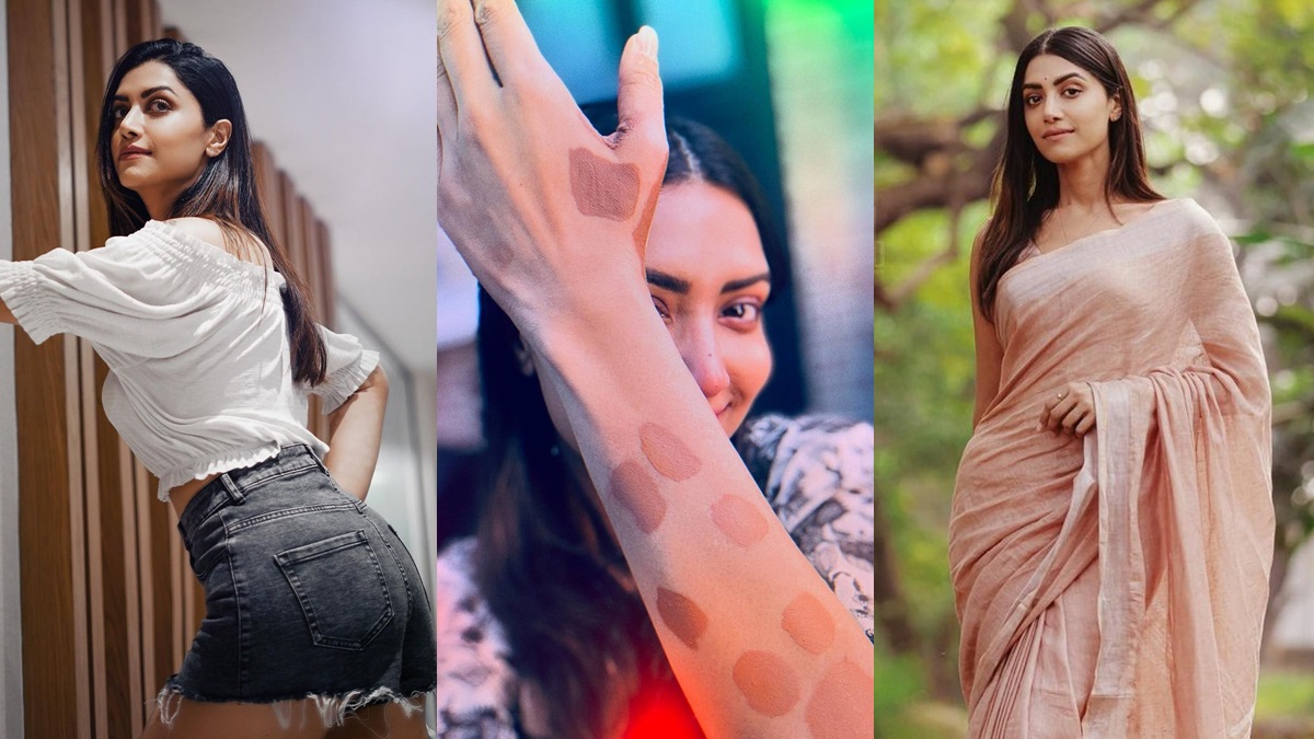 Mamta Mohandas Shares Her Skin Problem Revealing Photo On World ...